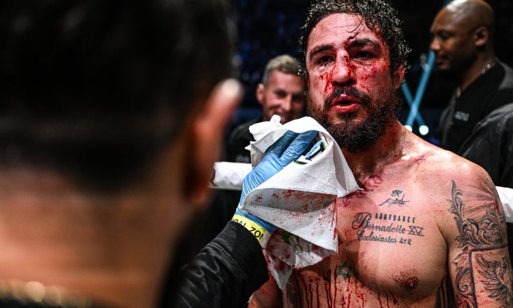 El exluchador de la UFC Diego Sánchez pierde en su debut en Bare ...